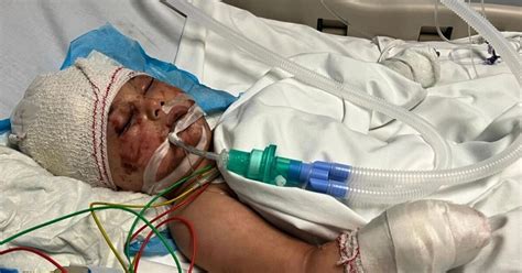 Sole Survivor Two Year Old Ali Khalifehs Ordeal