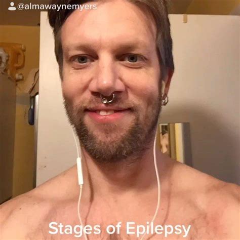 Heres Me Over The Years Since Losing 60 Lbs Of Muscle To Almost Dying Epilepsyawareness