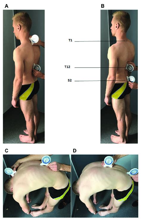 Positioning Of The Two Inclinometers For The Evaluation Of The Spine Download Scientific