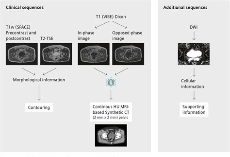 Figure 3 From Mr Based Synthetic Ct Reimagined Semantic Scholar