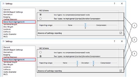 Nerve Root Compression Settings CoLumbo