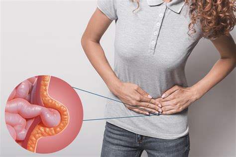 Паховая грыжа лечение в Ставрополе