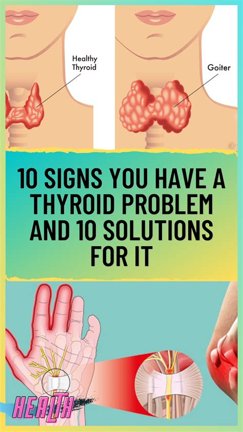 10 Signs You Have A Thyroid Problem And 10 Solutions For It