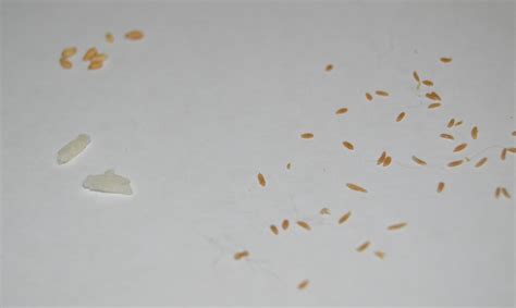 What Do Tapeworms Look Like In Cats