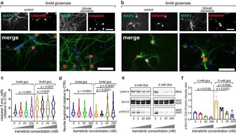 Newly Discovered Subtypes And Sex Differences Give Insight Into