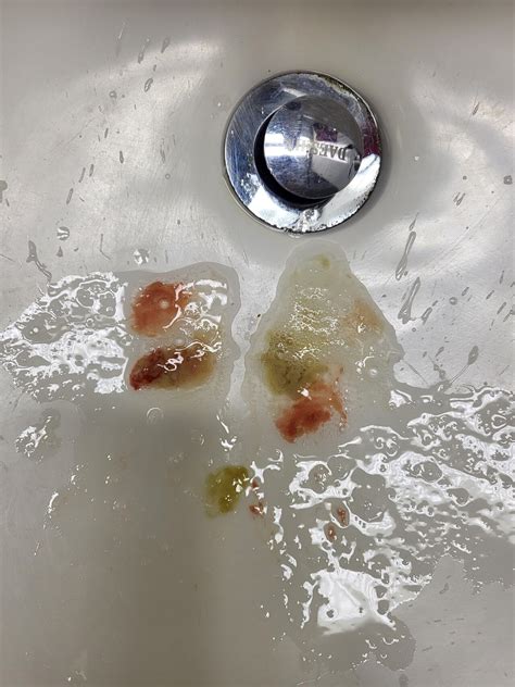 블라인드 블라블라 피가래 나오는데혐짤주의