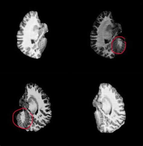 Shape Inconsistency · Issue 408 · Junyanzpytorch Cyclegan And Pix2pix