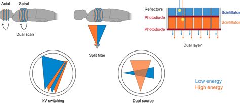 milestones in ct past present and future radiology