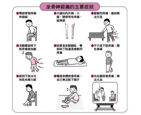 7个动作缓解坐骨神经痛 每日头条
