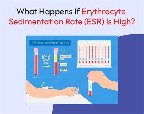 What Happens If Erythrocyte Sedimentation Rate Esr Is High