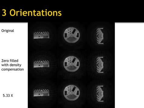 Introduction To Compressed Sensing Mri Pdf