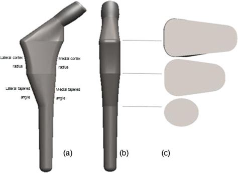 Cementless Femoral Stem Design According To The Femur Morphology A Download Scientific
