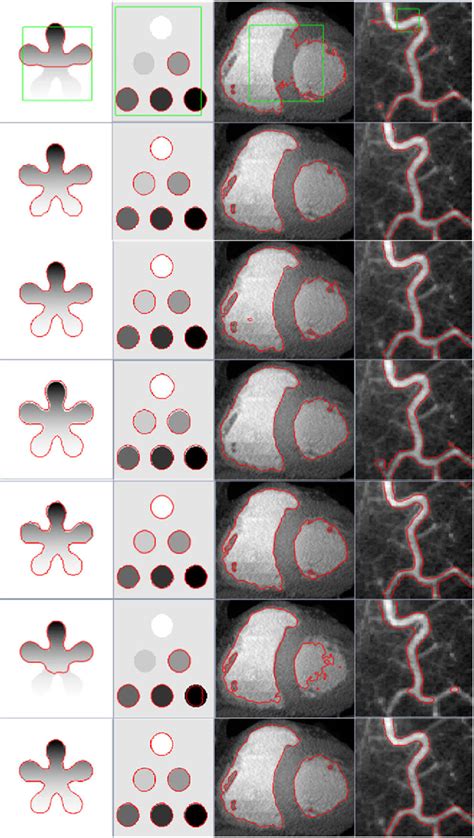 Figure From An Active Contour Model Based On Local Fitted Images For Image Segmentation