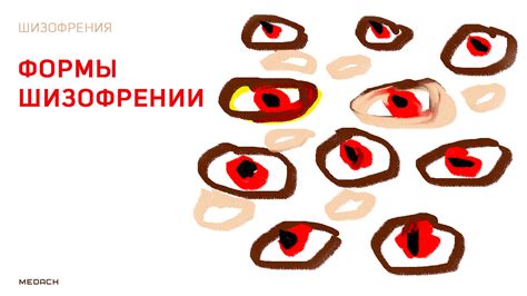 Шизофрения Формы шизофрении