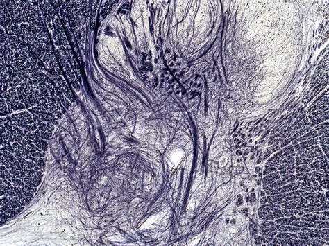 Spinal Cord Nerve Tracts Lumbar Lm Stock Image C0362472