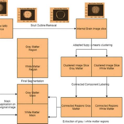 Block Diagram Of Automatic Gray And White Matter Segmentation Download Scientific Diagram