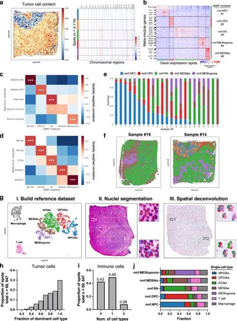 Spatial Cellular Architecture Predicts Prognosis In Glioblastoma Nature… Yuanning Zheng
