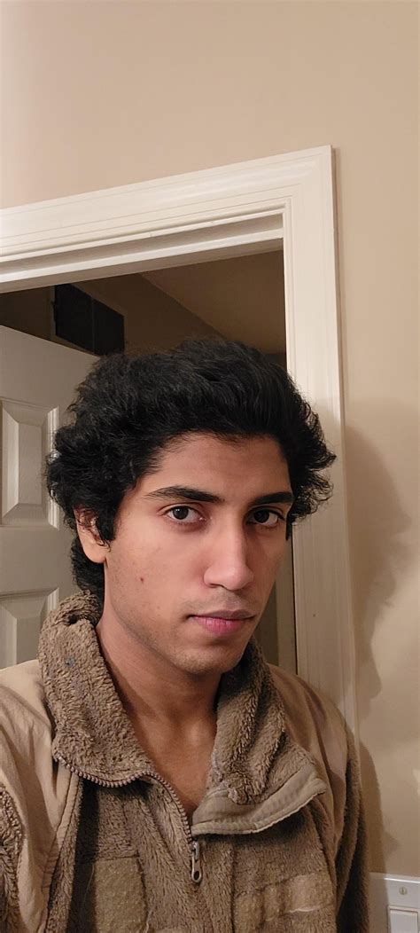 Deviated Septum Kindve Been Thinking About A Nose Job But I Still