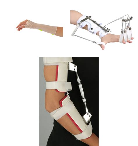 Wrist Hand And Elbow Orthosisbraces Ideal Artificial Limbs Solution