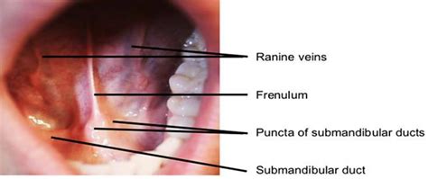 Lingual Frenulum Anatomy