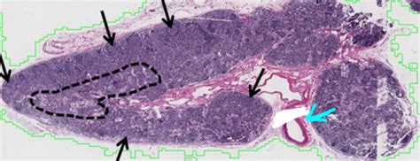 Lymph Node Spleen Flashcards Quizlet
