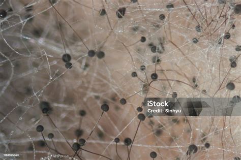 Rhizopus Di Bawah Mikroskop Foto Stok Unduh Gambar Sekarang Istock