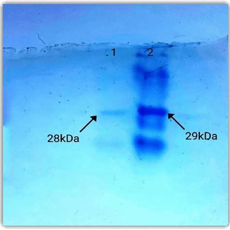 Polygalacturonase Activity Of L Amnigena Control Represent The Download Scientific Diagram