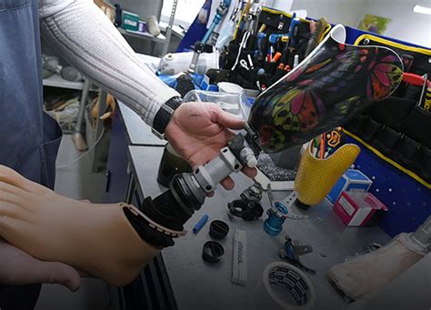 custom prosthetic socket design and fabrication in las vegas