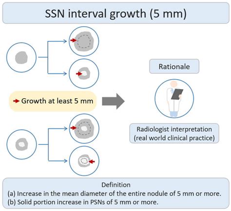 Managing Persistent Subsolid Nodules In Lung Cancer Encyclopedia Mdpi