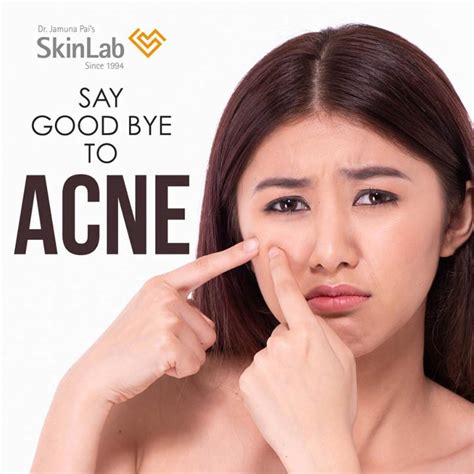 Deal With Adult Acne Effectively Saachi Baat