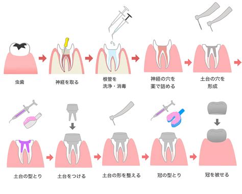 歯科治療はどうして1回で終わらないの？ おりはら歯科医院