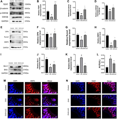 The Wnt β catenin signaling pathway inhibits osteoporosis by regulating