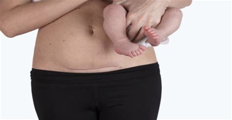 Best Caesarean Section Doctors In Kharghar Dr Sonal Bhangale