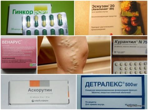 Таблетки от варикоза вен на ногах: список лучших препаратов, цены, отзывы