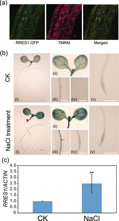subcellular localization and tissue specific expression pattern of