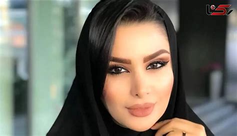 عکس زخم عمیق صورت دنیا جهانبخت بدجوری کتک خورد