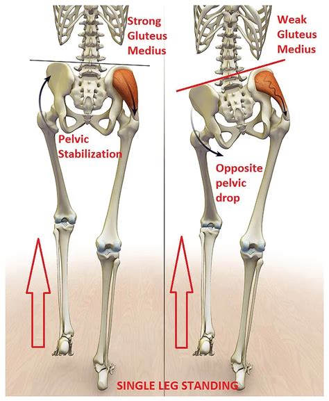 Single Leg Exercises For Muscle Imbalance At Sandra Wells Blog