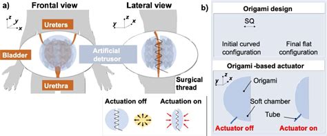 Figure 1 From A Hydraulic Soft Robotic Detrusor Based On An Origami Design Semantic Scholar