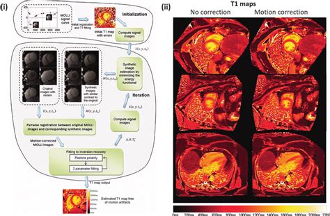5 I Respiratory Motion Corrected T1 Mapping Framework Based On