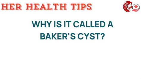 Unveiling The Mystery Why Is It Called A Bakers Cyst