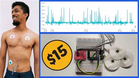 Iot Based Low Cost Ecg Heart Monitoring System With Esp And Ubidots Platform Electronics
