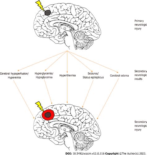 Figure 1 From Approaches To Neuroprotection In Pediatric Neurocritical