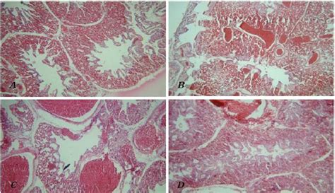 Sections Of Lungs Showing A And B Engorgement Of Blood Capillaries In