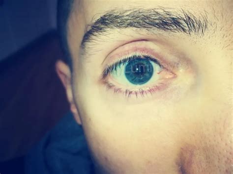 Eye Color Evolution In Humans