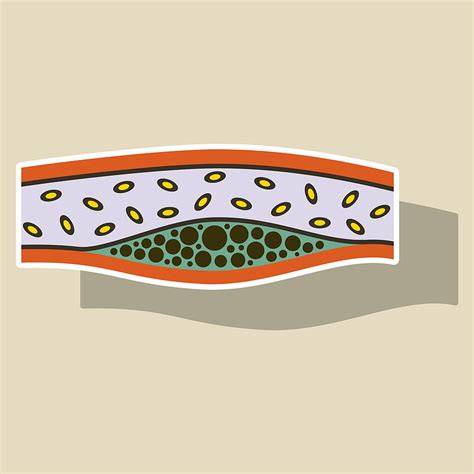 스티커 비엔나 인간 죽상 경화증 구조 벡터 Ai Eps Uidownload