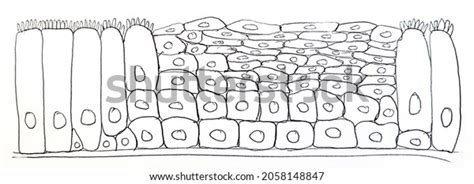 Squamous Metaplasia Respiratory Epithelium Consequence Cigarette Stock