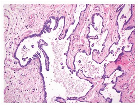 Pampiniform Plexus Histology Male Page 1