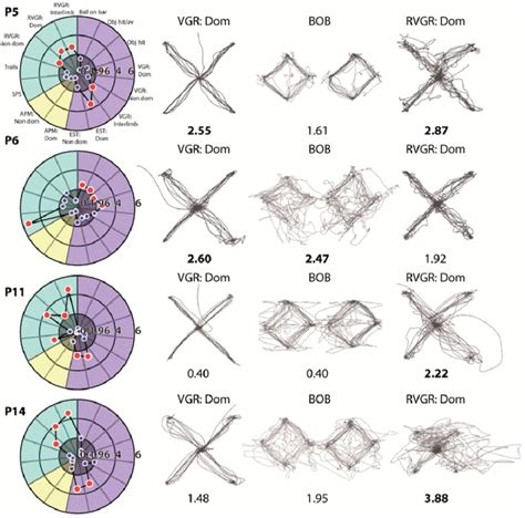 Example Patient Performance On Robotic Assessment Tasks Each Row