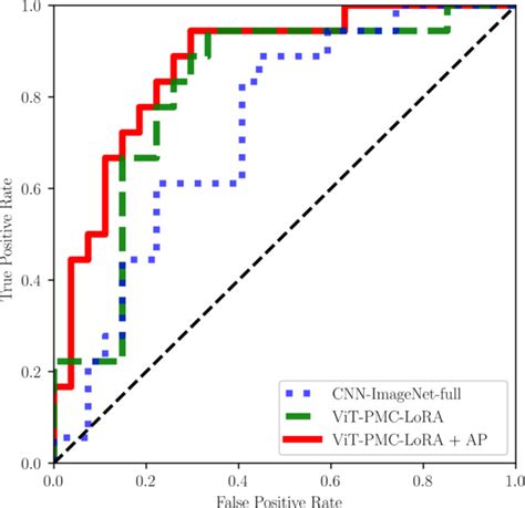 Augmented Prediction Of Vertebral Collapse After Osteoporotic Vertebral Compression Fractures