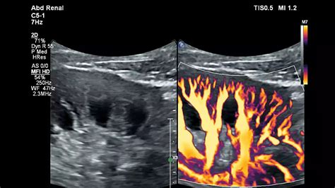 Microflow Imaging Products And Services Philips